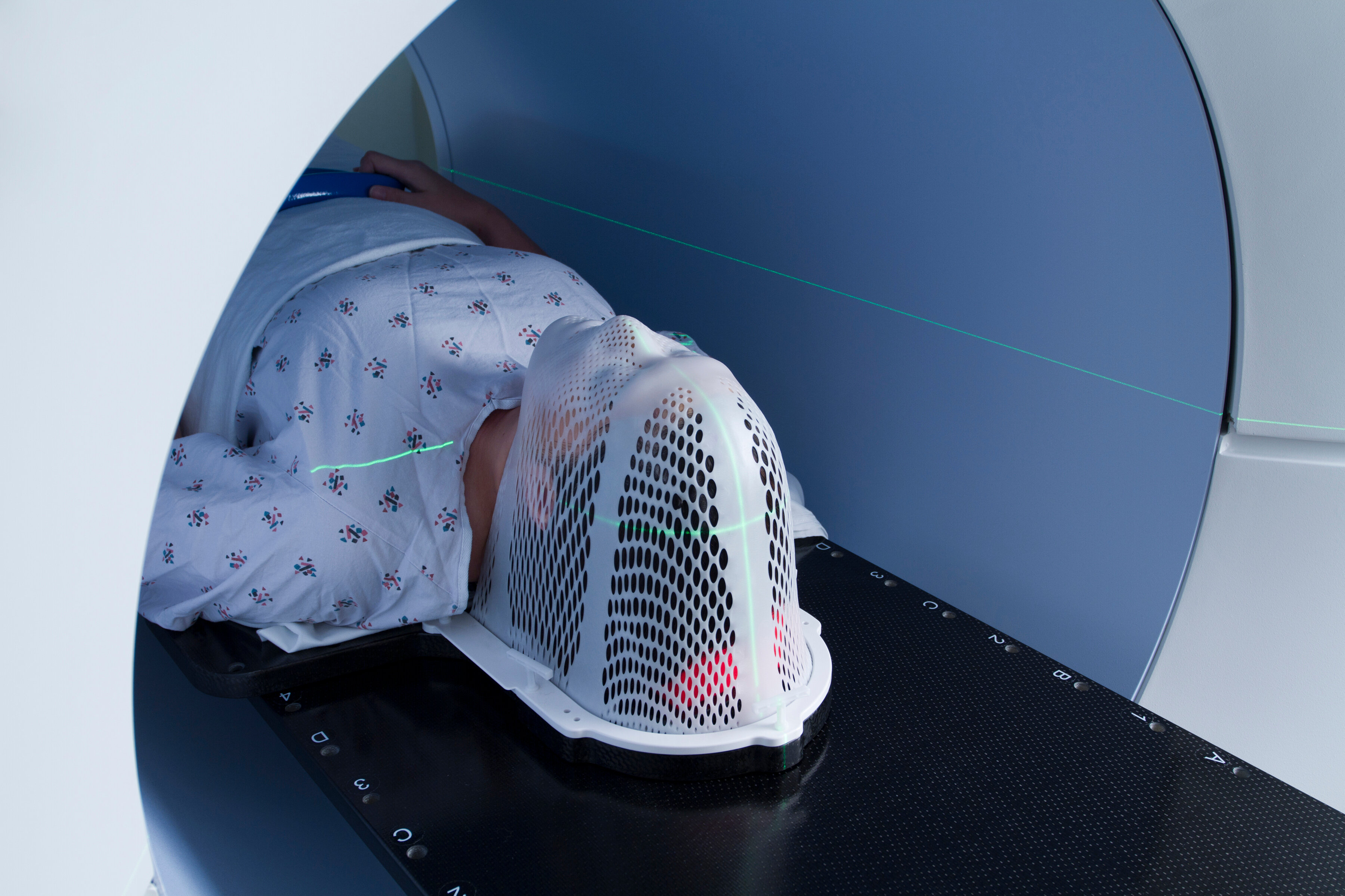 Moldcare In Radiation Therapy For Brain Cancer ALCARE Technical Moldcare In Radiation Therapy For Brain Cancer ALCARE Technical